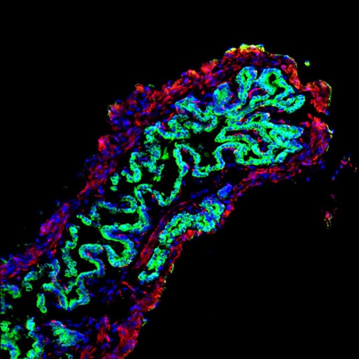 Repaired Mouse Gallbladder [IMAGE] | EurekAlert! Science News Releases