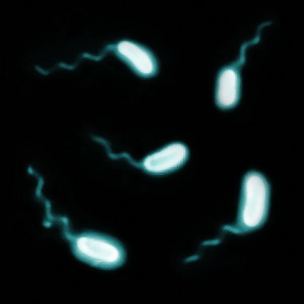 Vibrio Vulnificus [IMAGE] | EurekAlert! Science News Releases