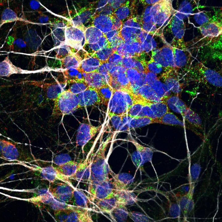 Motor Nerve Cells [IMAGE] | EurekAlert! Science News Releases