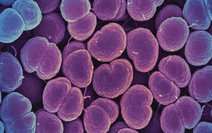 Neisseria gonorrhoeae [IMAGE] | EurekAlert! Science News Releases