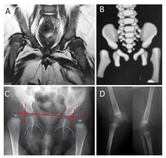 Radiological Features [IMAGE] | EurekAlert! Science News Releases