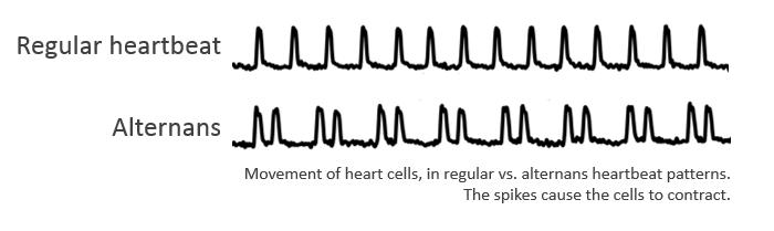 The Pattern of Alternans [IMAGE] | EurekAlert! Science News Releases