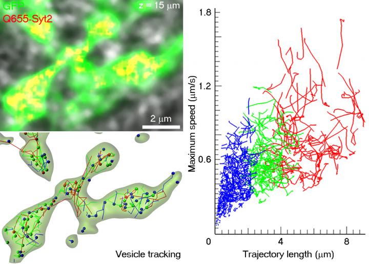 Vesicles Have a Wide Pattern o [IMAGE] | EurekAlert! Science News Releases