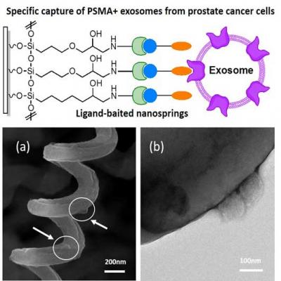 SEM and TEM Images of LNCaP Ex [IMAGE] | EurekAlert! Science News Releases