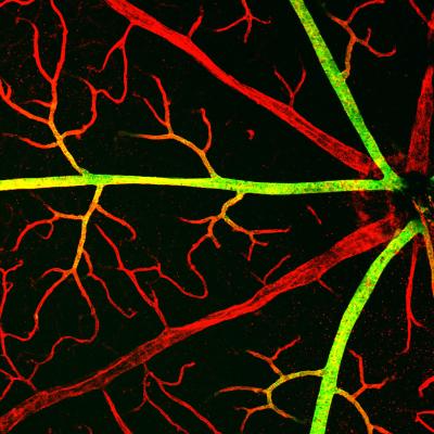 Blood Vessels of the Retina [IMAGE] | EurekAlert! Science News Releases
