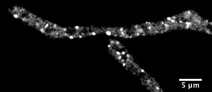Droplets in Ashbya Ce [IMAGE] | EurekAlert! Science News Releases