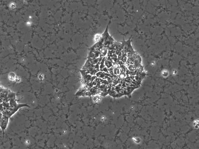 hES Cells on Matrigel Alone [IMAGE] | EurekAlert! Science News Releases