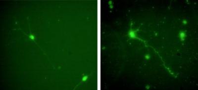 Neuron Growth [IMAGE] | EurekAlert! Science News Releases