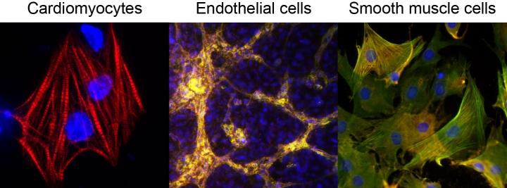 Three Types of Heart Cells Cre [IMAGE] | EurekAlert! Science News Releases