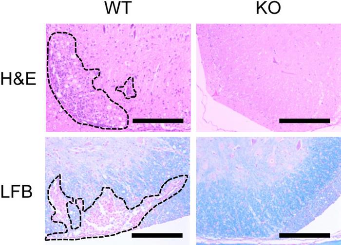 Role of STAP-1 in autoimmune d [IMAGE] | EurekAlert! Science News Releases