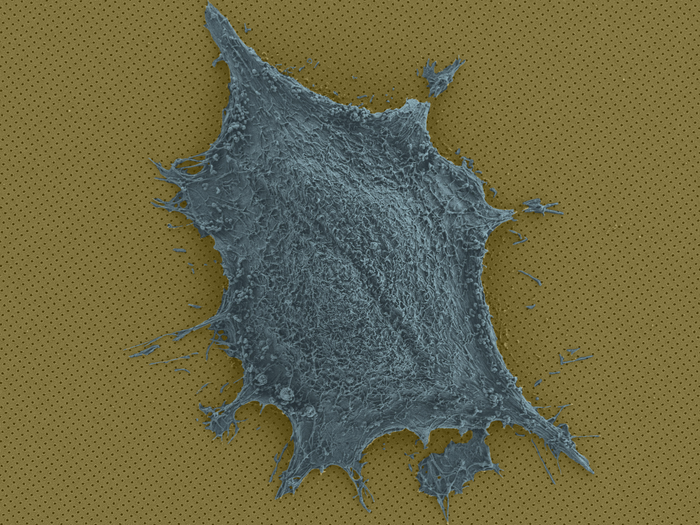 Single cell on a chip [IMAGE] | EurekAlert! Science News Releases