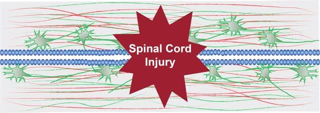 Scientists find key protein for spinal cord r | EurekAlert!