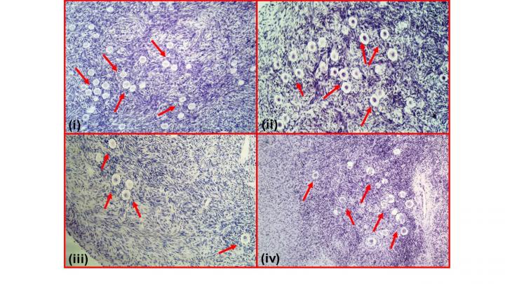 Ovarian Tissue [IMAGE] | EurekAlert! Science News Releases