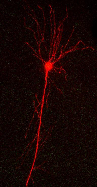 A Confocal Image of a Neuron W [IMAGE] | EurekAlert! Science News Releases