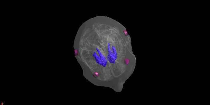 Non-invasive stimulation of th [IMAGE] | EurekAlert! Science News Releases