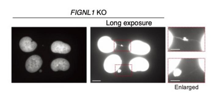 Cells lacking FIGNL1, a specia [IMAGE] | EurekAlert! Science News Releases