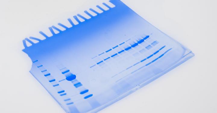 Protein gel [IMAGE] | EurekAlert! Science News Releases