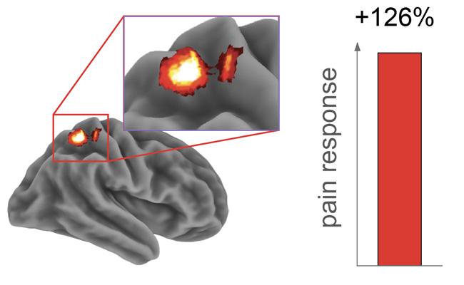 Somatosensory Cortex Response [image] Eurekalert Science News Releases