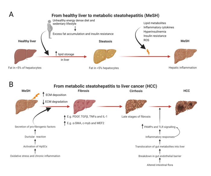New CMJ Review explores the metabolic dysfunc | EurekAlert!