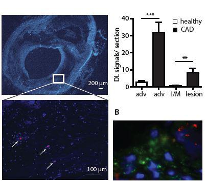A Dynamic Duo of Small Molecules Shape Immune | EurekAlert!