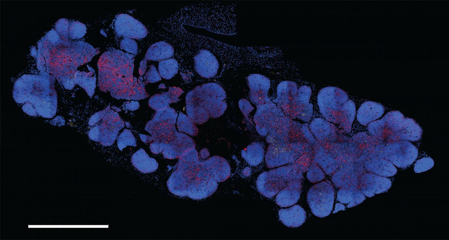 Image of Developing Human Thym [IMAGE] | EurekAlert! Science News Releases