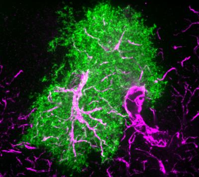Astrocyte [IMAGE] | EurekAlert! Science News Releases