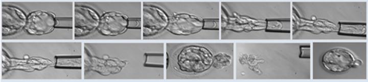 Blastocyst Biopsy [IMAGE] | EurekAlert! Science News Releases