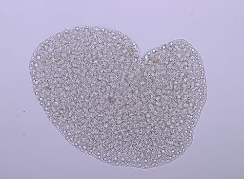 Trichoplax under the [IMAGE] | EurekAlert! Science News Releases