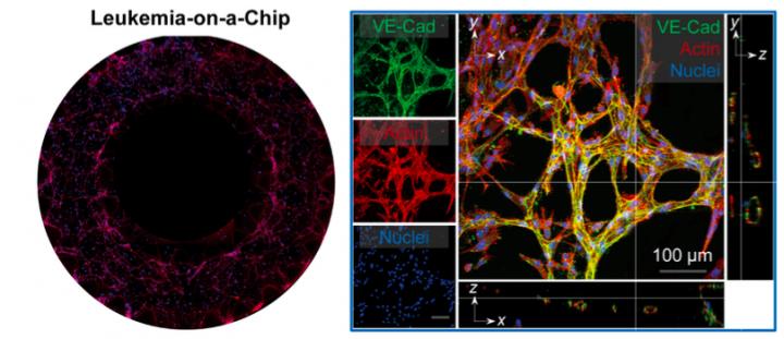 Image from Leukemia-On-A-Chip [IMAGE] | EurekAlert! Science News Releases
