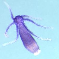 Seeing without eyes: Hydra stinging cells res | EurekAlert!