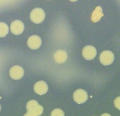 Control Over Bacterial Cheater [IMAGE] | EurekAlert! Science News Releases