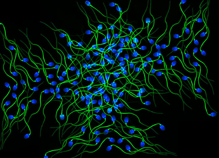 Human Sperm Cells [IMAGE] | EurekAlert! Science News Releases