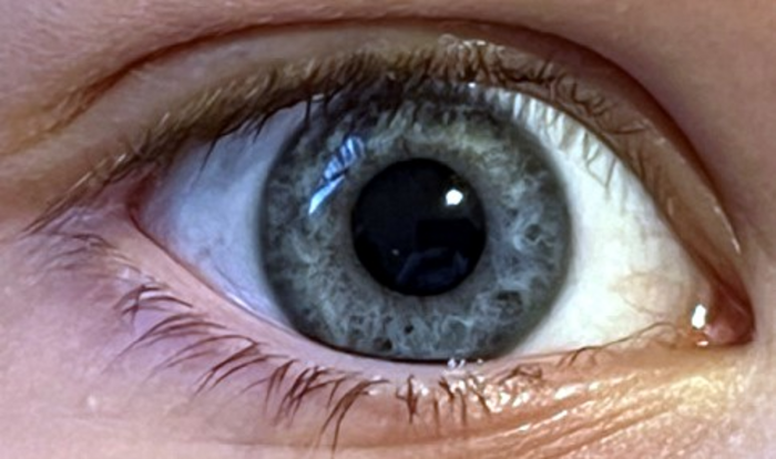 Eye-opening origin story: Scientists trace ke | EurekAlert!