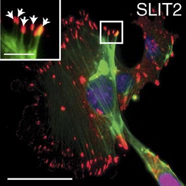 ROBO1 Activation [IMAGE] | EurekAlert! Science News Releases