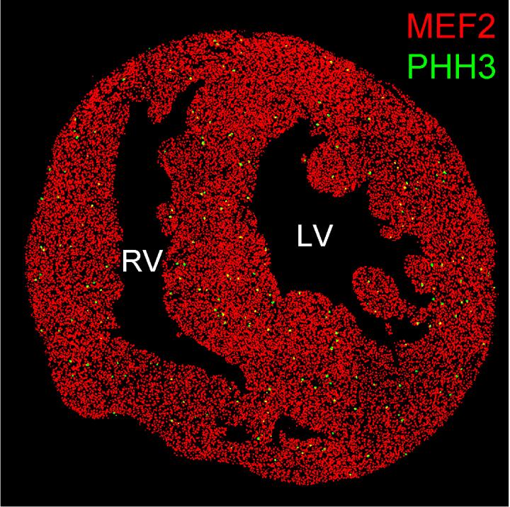 Neonatal Mouse Heart [IMAGE] | EurekAlert! Science News Releases