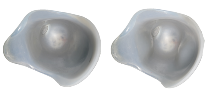 [Attachment 1-3] Before(left) [IMAGE] | EurekAlert! Science News Releases