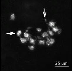 Sense of Touch Requires Mysterious Merkel Cel | EurekAlert!