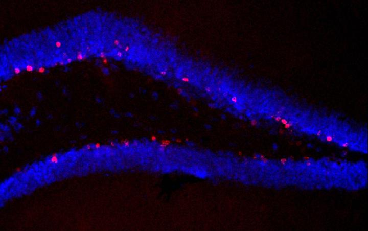 Microscopic Image of the Hippo [IMAGE] | EurekAlert! Science News Releases