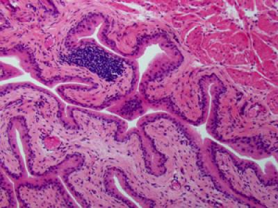 Immune Overreaction [IMAGE] | EurekAlert! Science News Releases