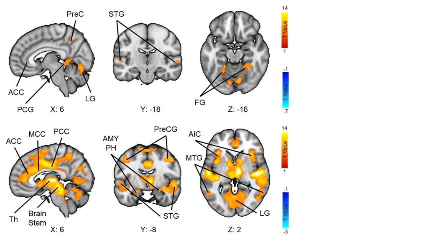 Figure 1: Active Brain Regions [IMAGE] | EurekAlert! Science News Releases