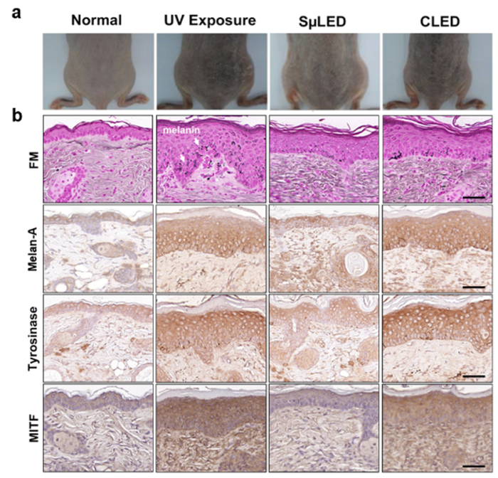 The efficacy of melanogenesis [IMAGE] | EurekAlert! Science News Releases