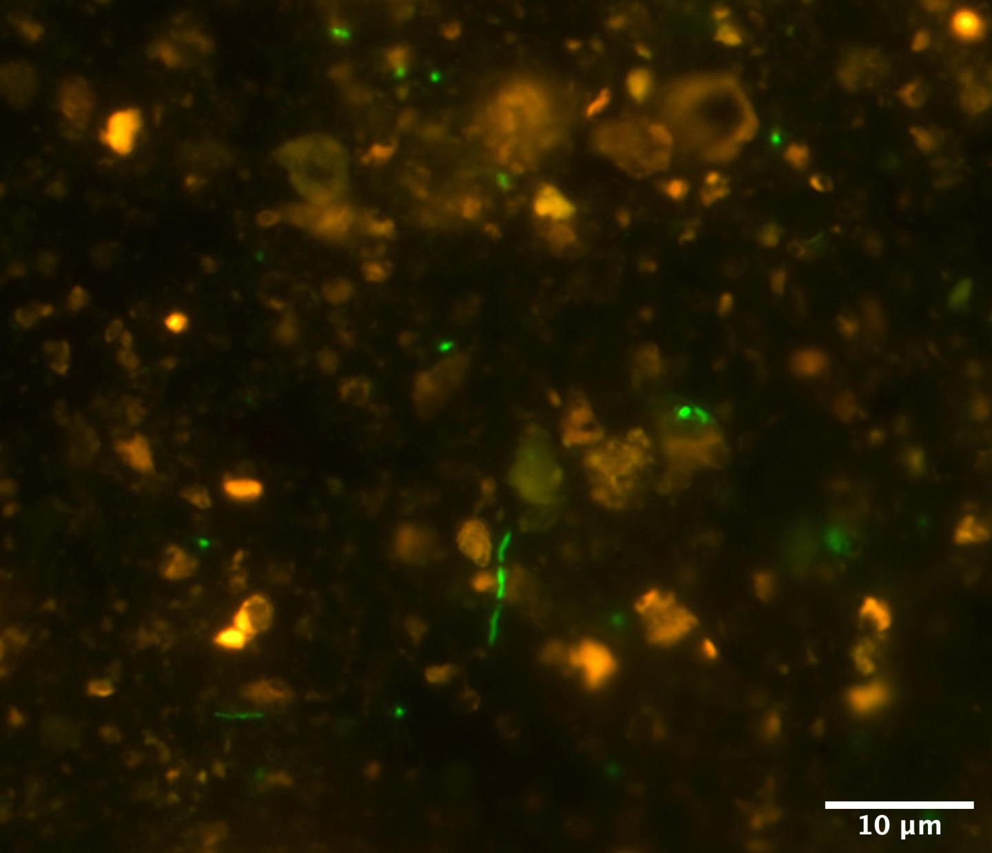 Global analysis of microbial diversity in mar | EurekAlert!