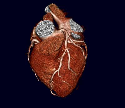 Heart Slice [IMAGE] | EurekAlert! Science News Releases