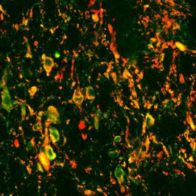 Selective Activation of LC Neu [IMAGE] | EurekAlert! Science News Releases