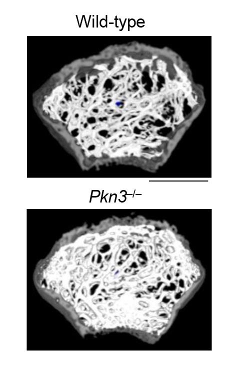 Boning Up on Skeletal Break Down (1 of 1) | EurekAlert!