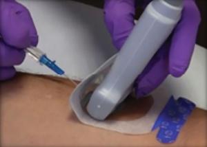 Sterile barrier dressing increases efficiency | EurekAlert!