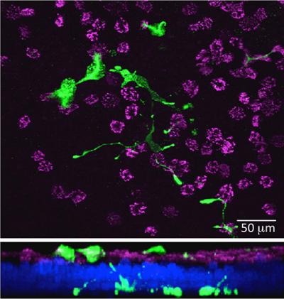 Pulmonary Endocrine Cells [IMAGE] | EurekAlert! Science News Releases