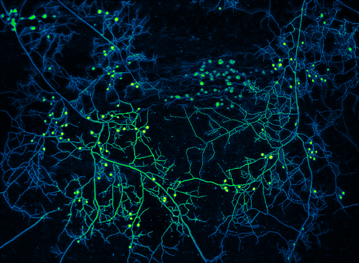 Mycelium of arbuscular mycorrh [IMAGE] | EurekAlert! Science News Releases