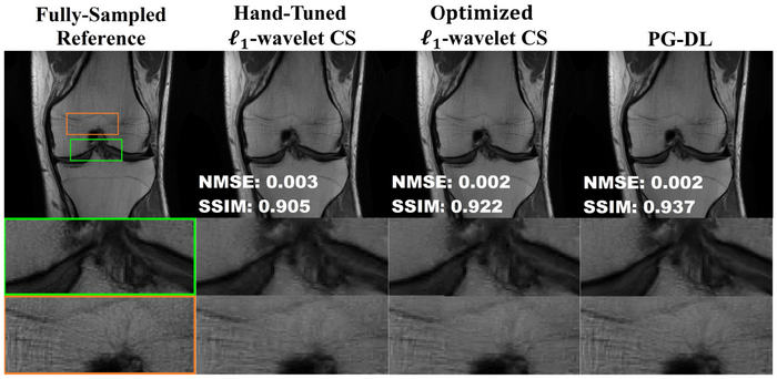 Knee MRI example [IMAGE] | EurekAlert! Science News Releases