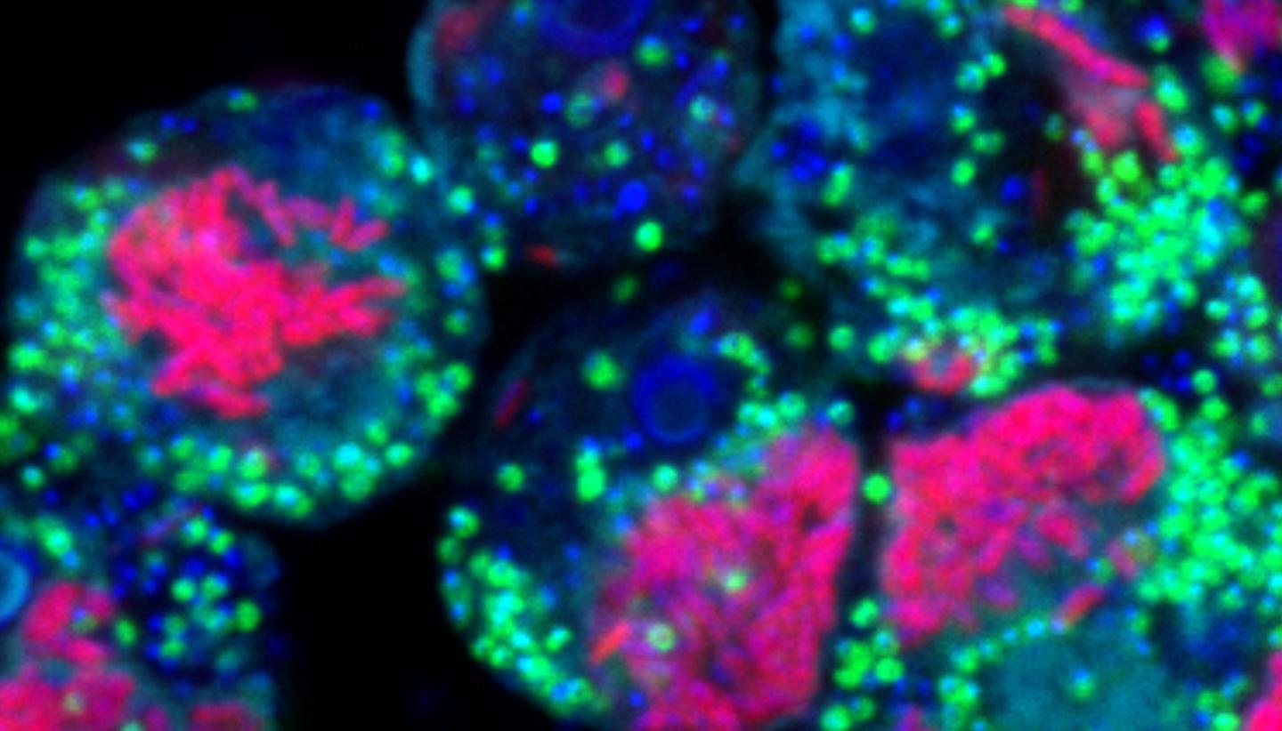 Legionella [IMAGE] | EurekAlert! Science News Releases